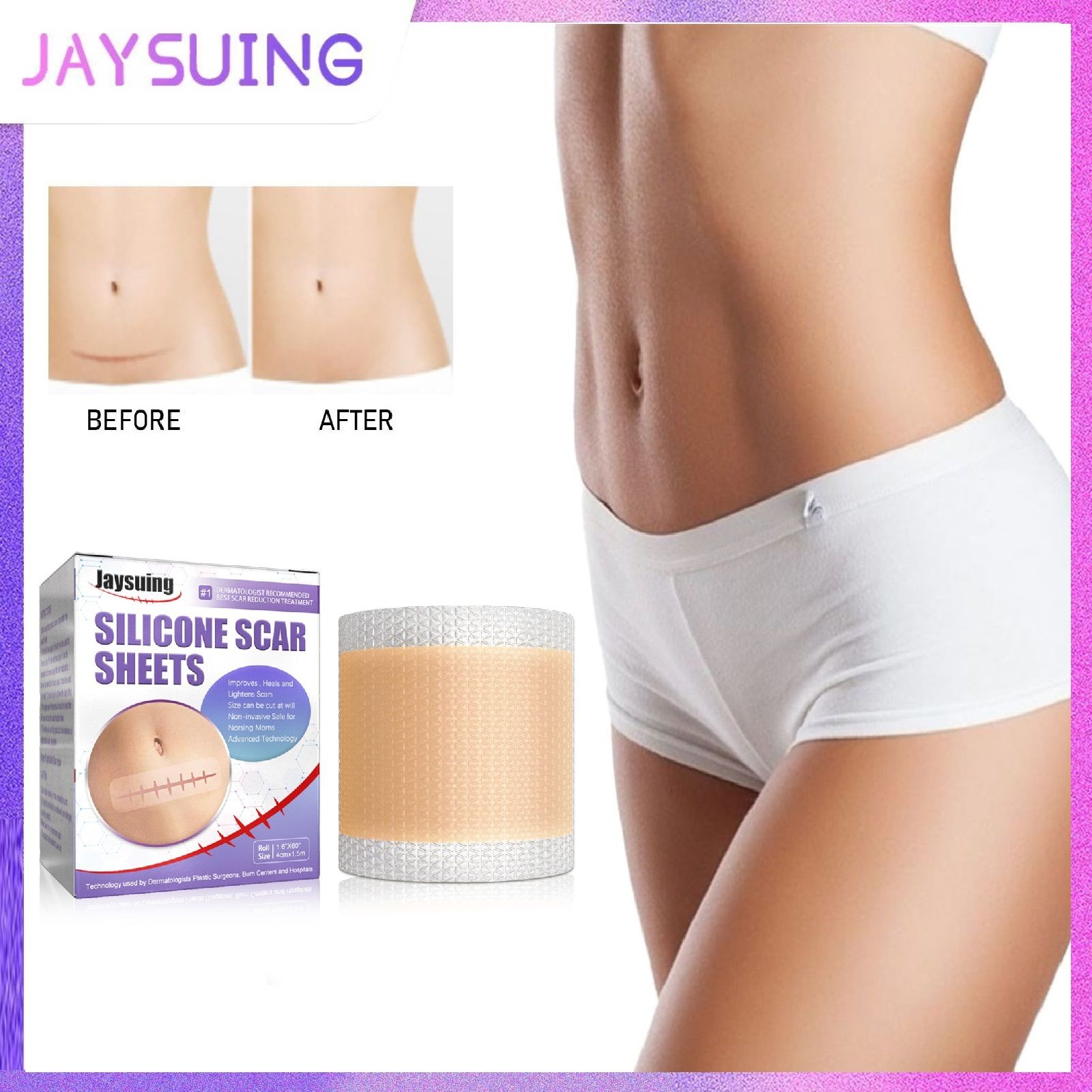 Jaysuing Silicone Scar Sheets | Jaysuing Official Website