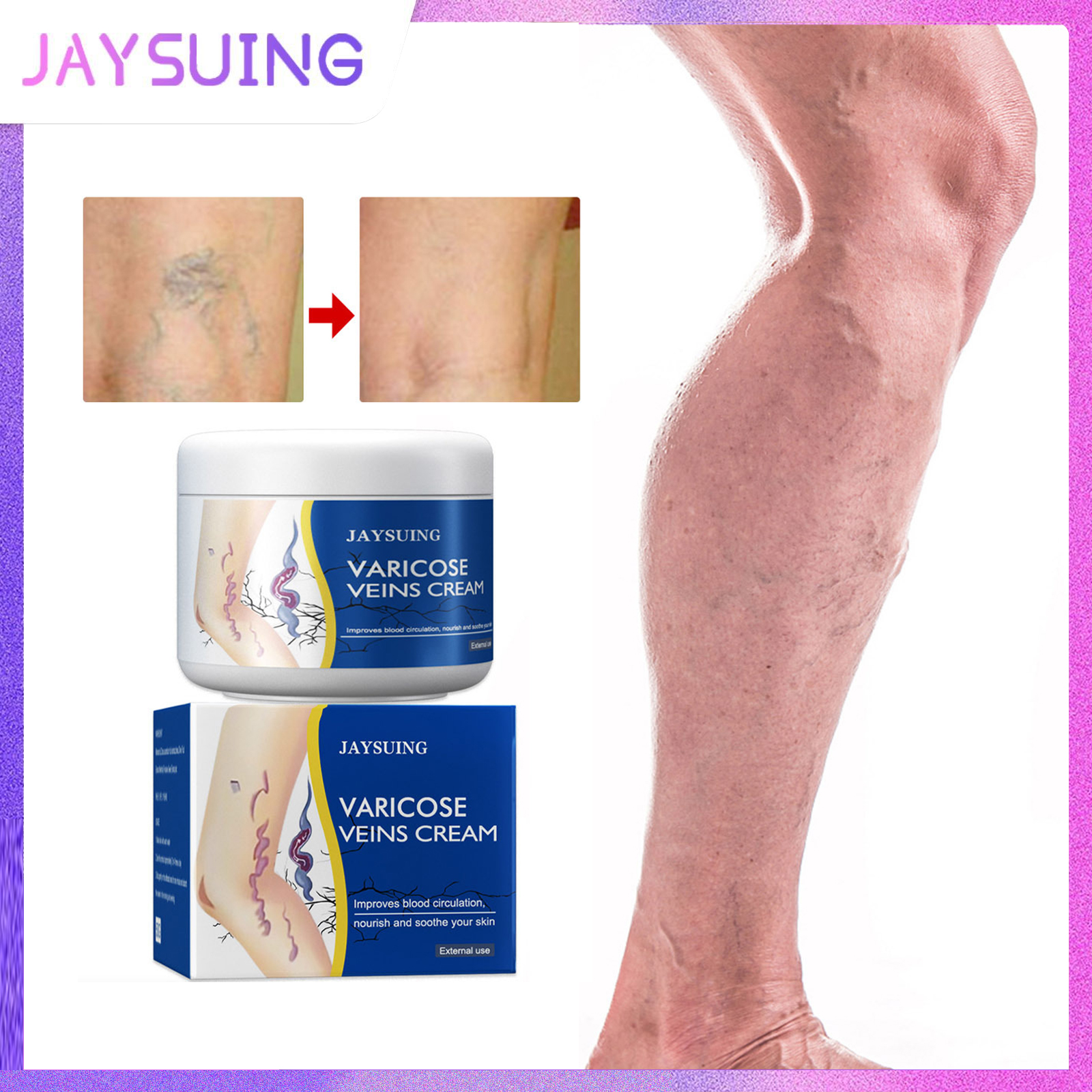 Jaysuing Varicose Vein Cream | Jaysuing Official Website