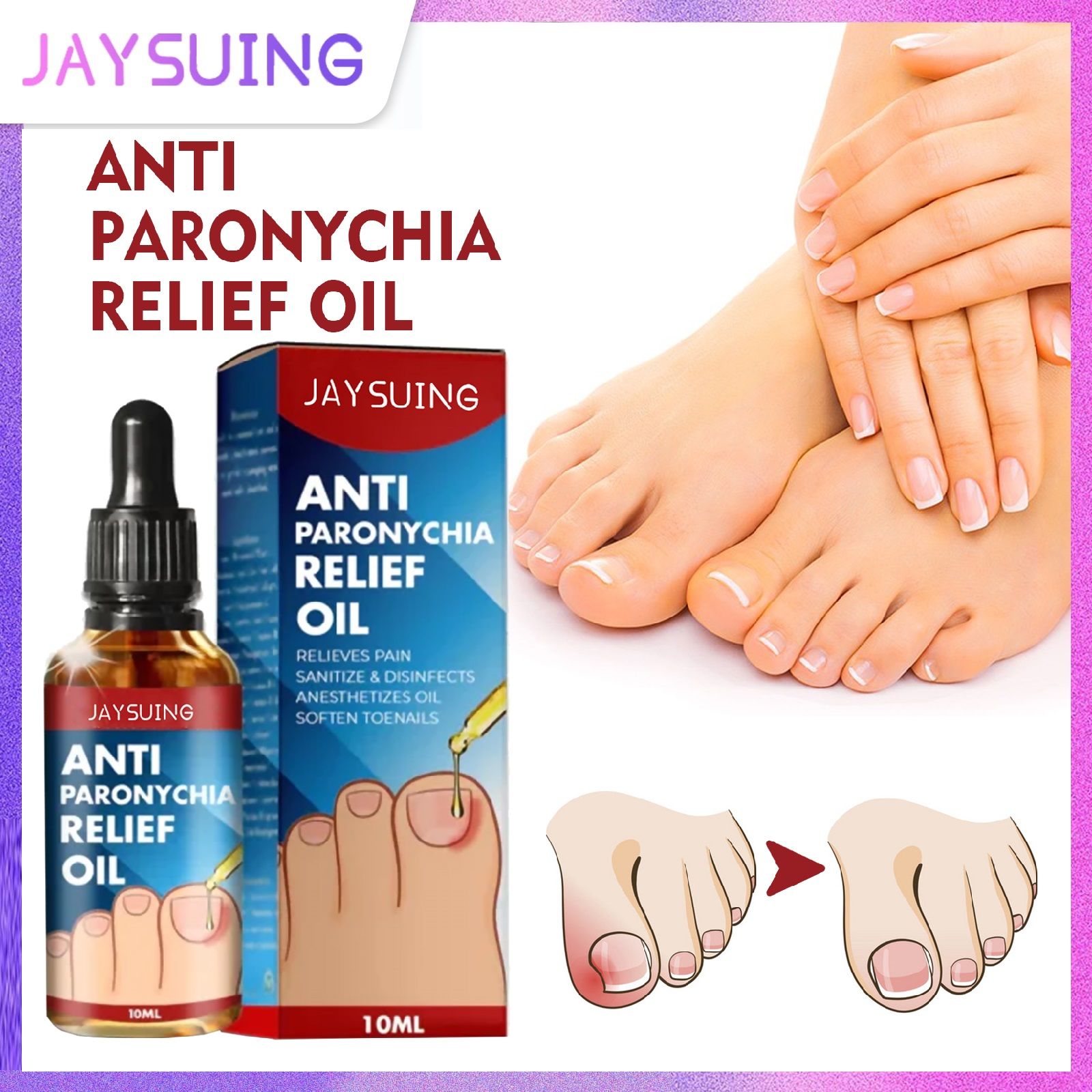 Jaysuing Anti Paronychia Relief Oil | Jaysuing Official Website