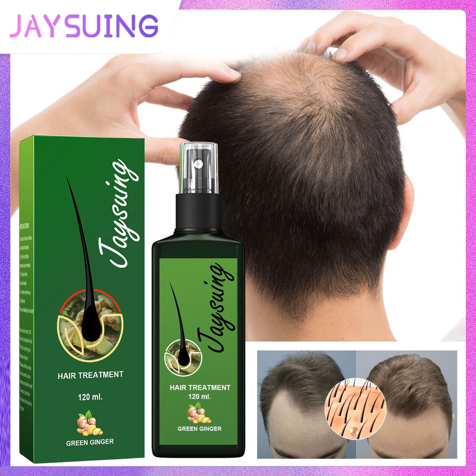 Jaysuing Hair Growth Spray | Jaysuing Official Website