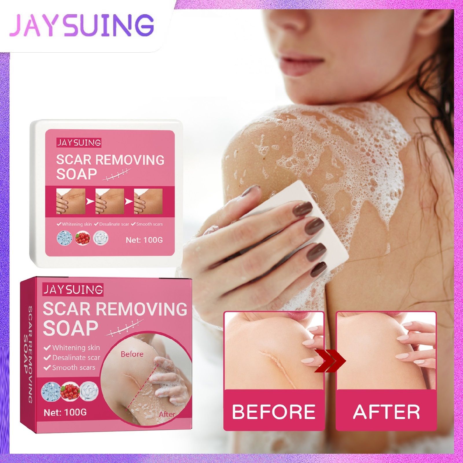 Jaysuing Scar Removal Soap Stretch Marks | Jaysuing Official Website