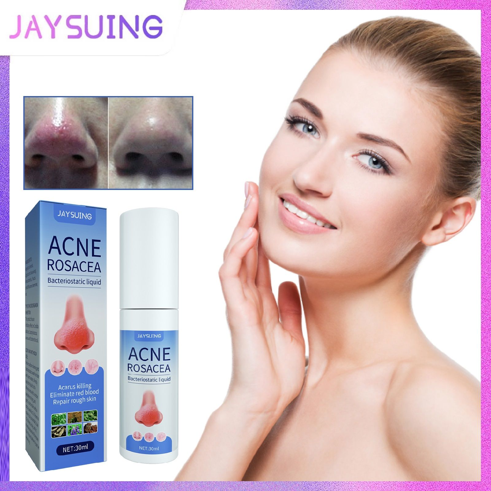 Jaysuing Rosacea Remover Serum | Jaysuing Official Website