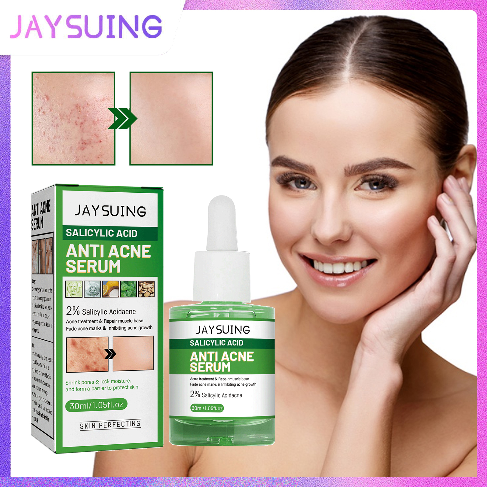 Jaysuing Acne Treatment Face Serum | Jaysuing Official Website
