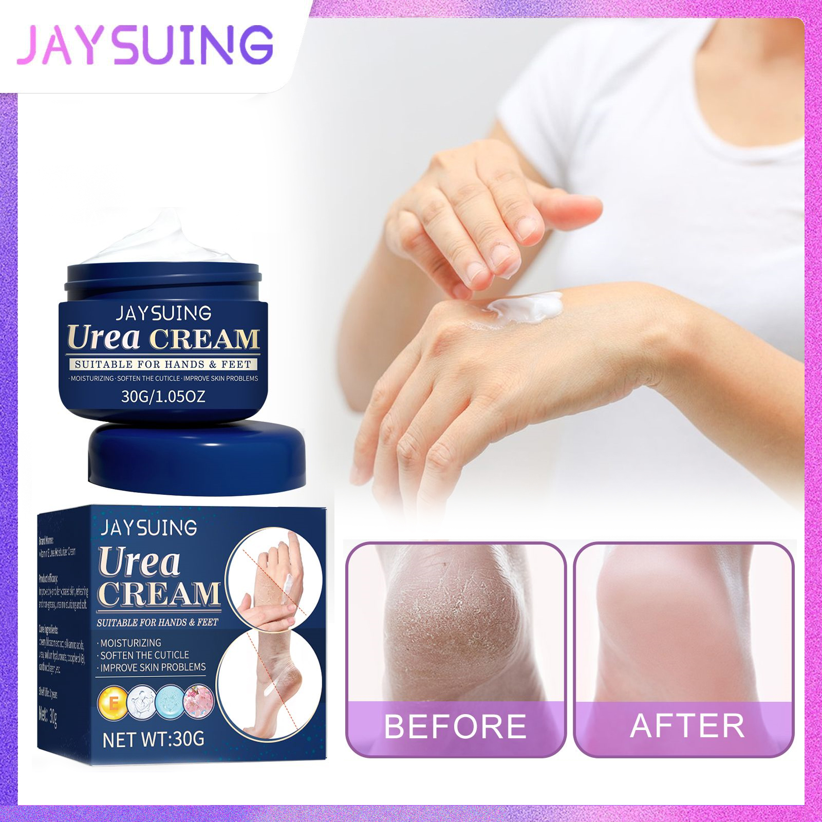 Jaysuing Urea Crack Cream | Jaysuing Official Website